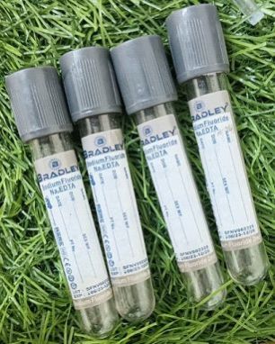 Transparent Round Vacuum Sodium Fluoride Blood Collection Tube, for ...