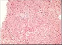 Umedica Laboratory Pvt. Ltd. in Vapi - Manufacturer of Paracetamol ...