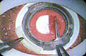 Retailer of artificial eye & hoya isert 250 | SMR Lens, Mumbai